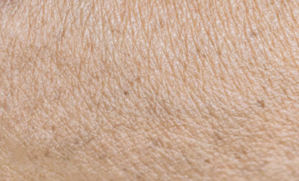 Skin Conditions: What Your Body Is Trying to Tell You - Dr. Christina ...